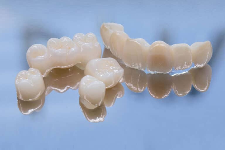 High-Quality Dental Crowns in Vaughan, Concord, and Woodbridge
