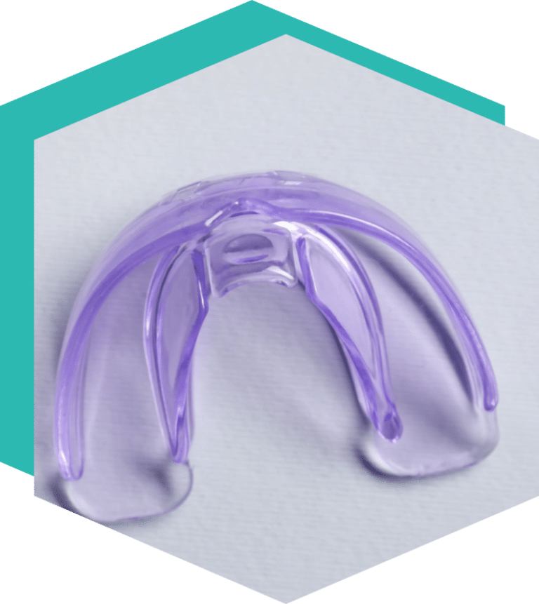 Custom Sports Mouthguards in Vaughan, Concord, and Woodbridge